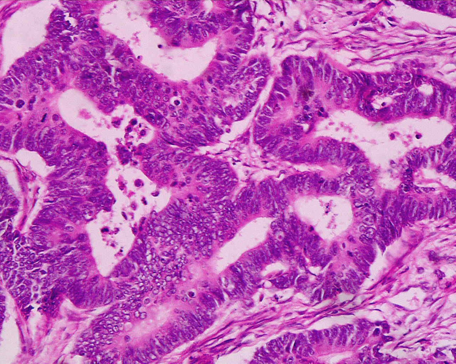 Sources Anatomo Cyto Pathologie Registre Des Cancers De Lisère